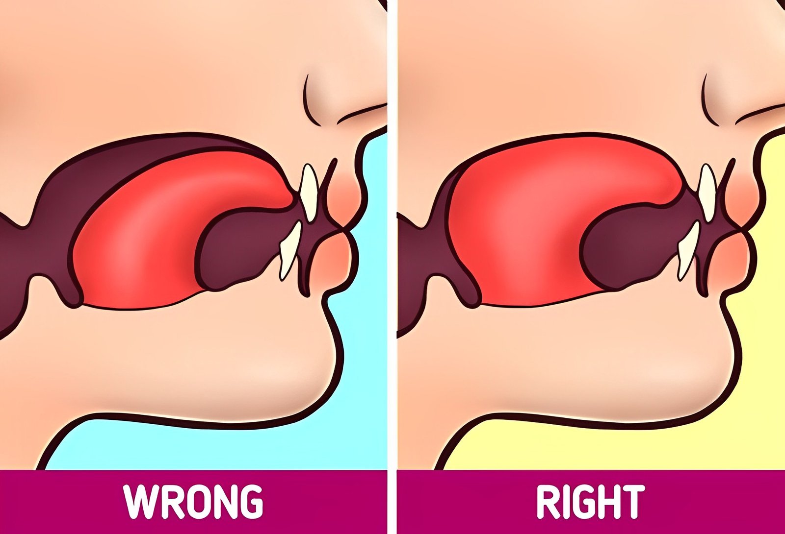 NASAL BREATHING VS MOUTH BREATHING - Optimal Sleep Airway Health