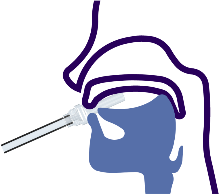 Mayo Clinic Studies REMplenish™ Myo-Nozzle's Impact on Sleep Apnea ...
